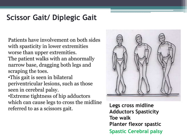 Gait abnormalities presentation | PPTX | Physical Therapy | Wellness