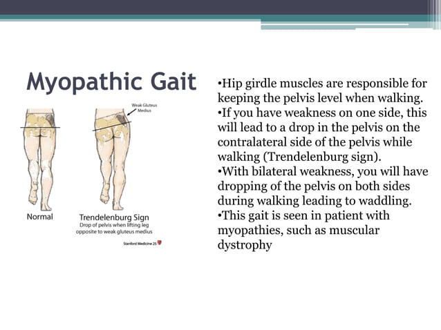 Gait abnormalities presentation | PPTX | Physical Therapy | Wellness