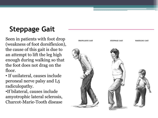 Gait abnormalities presentation | PPTX | Physical Therapy | Wellness