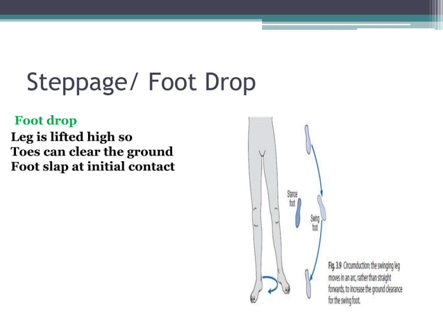 Gait abnormalities presentation | PPTX | Physical Therapy | Wellness