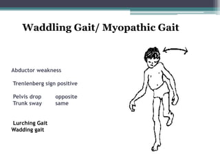 Gait abnormalities presentation | PPT