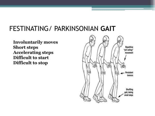Gait abnormalities presentation