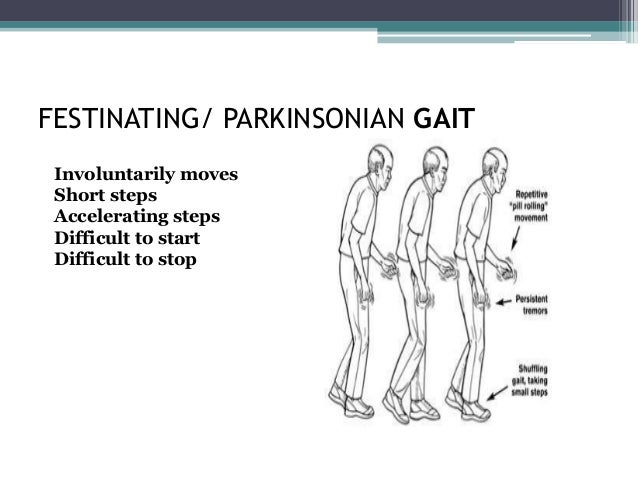 Gait abnormalities presentation