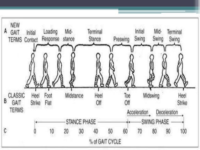 Gait abnormalities presentation