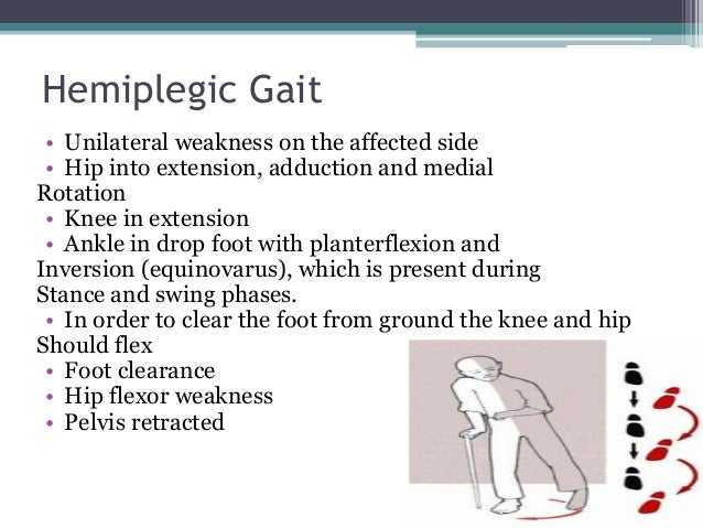 Gait abnormalities presentation