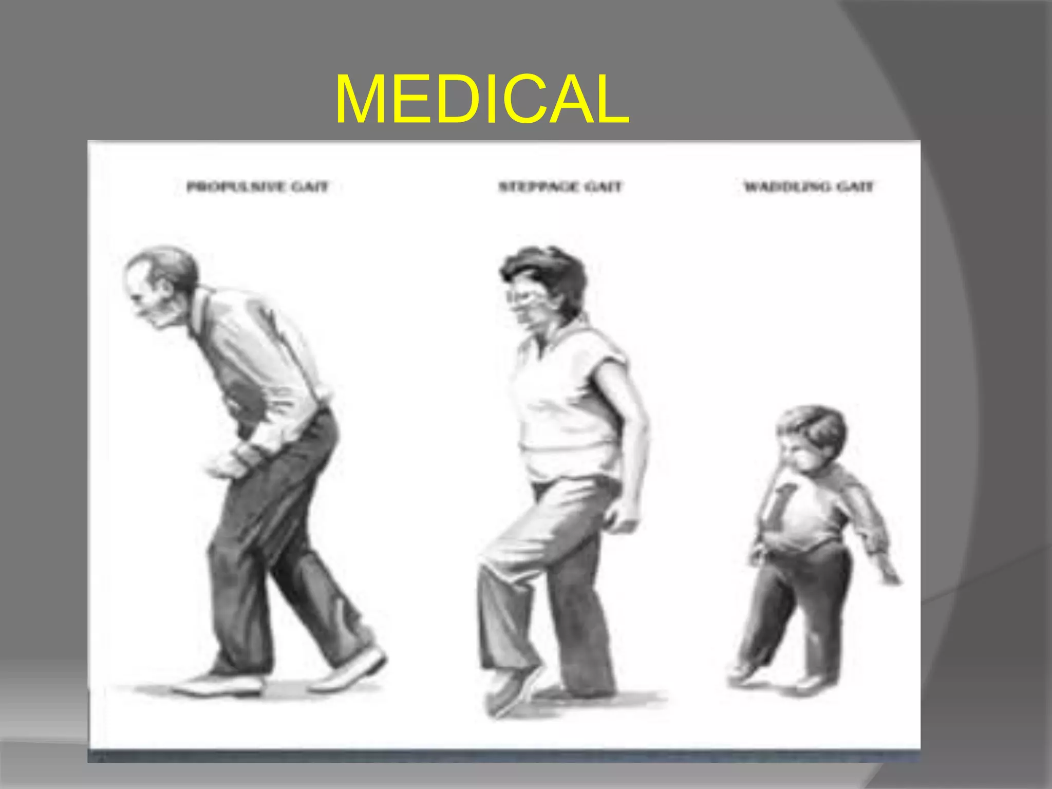 Gait analysis | PPTX
