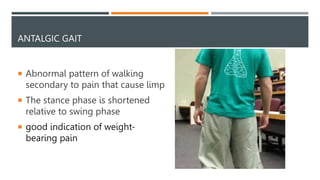 Gait Analysis.pptx
