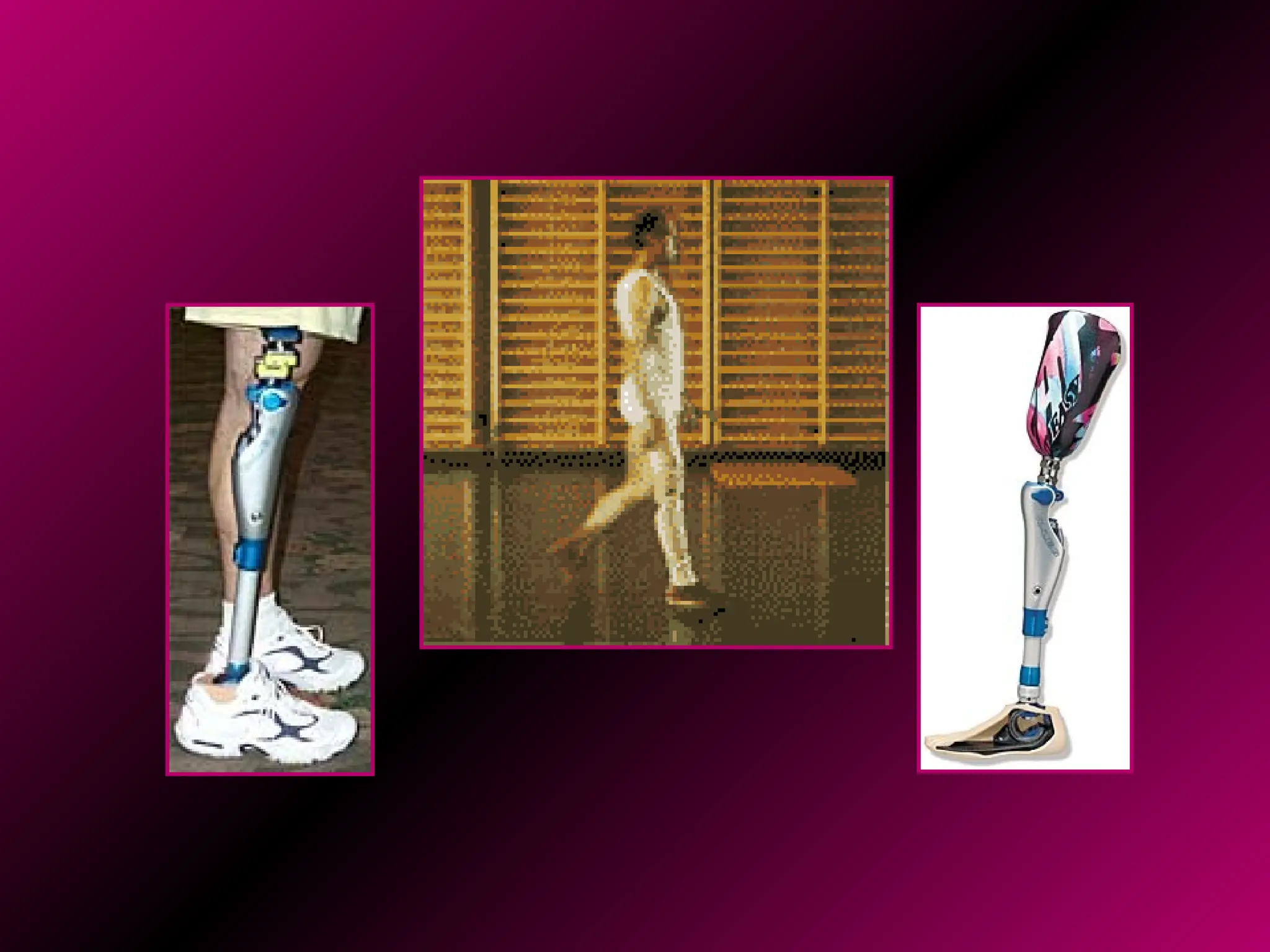 Gait Analysis Methods Temporal Analysis Kinematic Kinetic Analysis Ppt