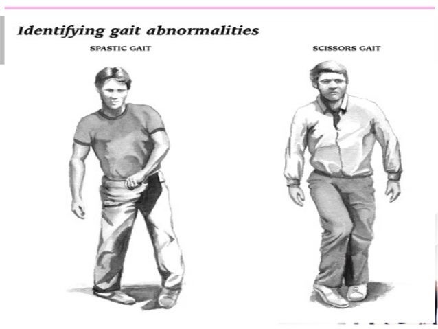 Gait analysis and.ppt by ramachandra