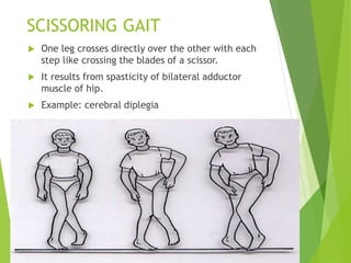Gait analysis dr himanshu | PPT