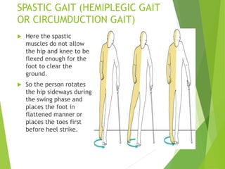 Gait analysis dr himanshu | PPT