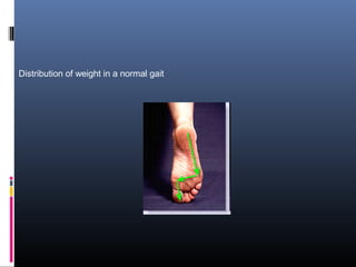Gait and gait abnormalities | PPT