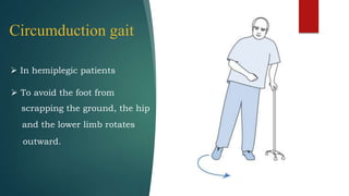 Circumduction Gait