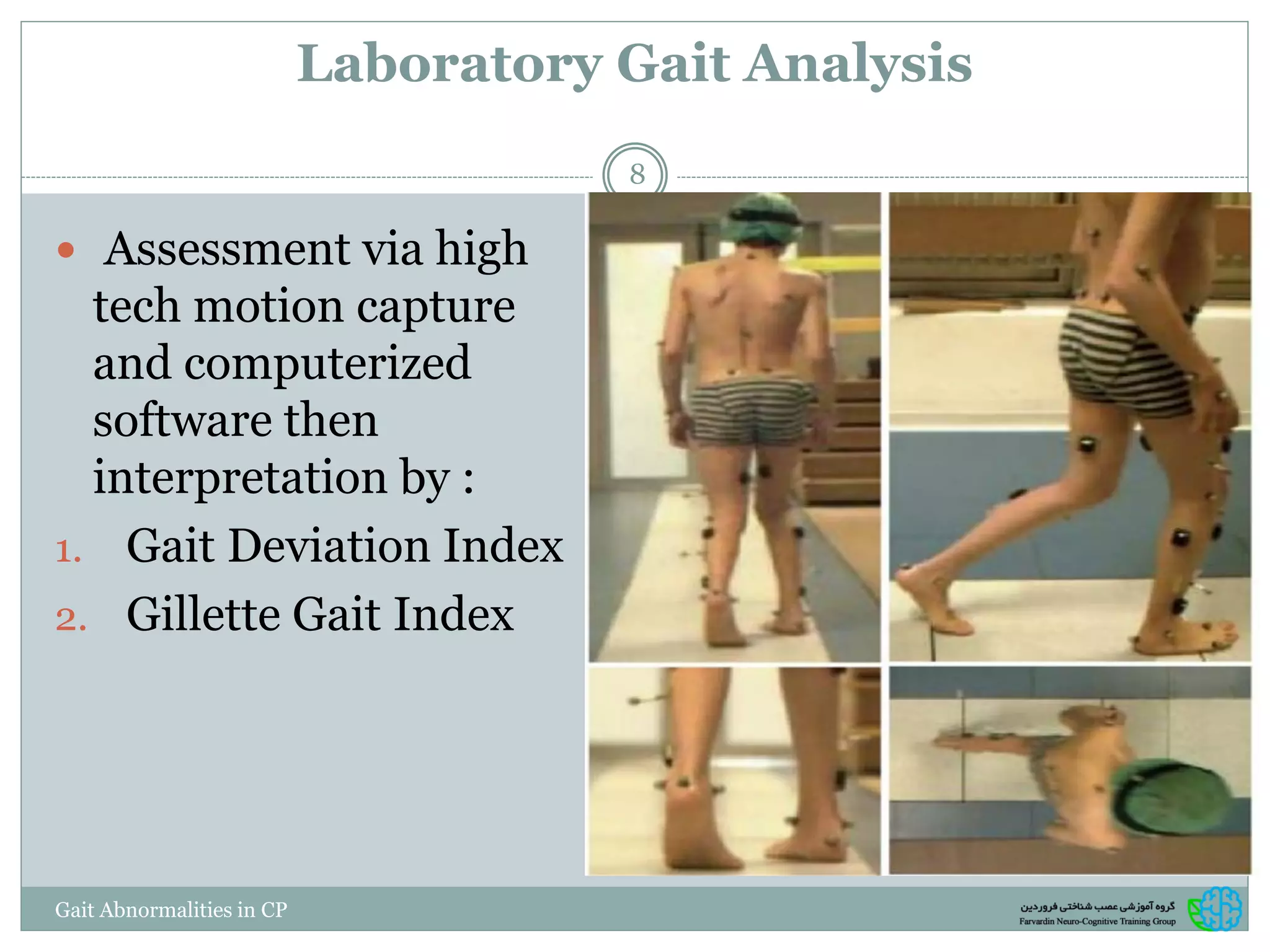Gait assessment in children with cp | PPT