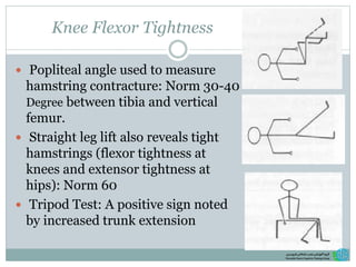 Gait assessment in children with cp | PPT