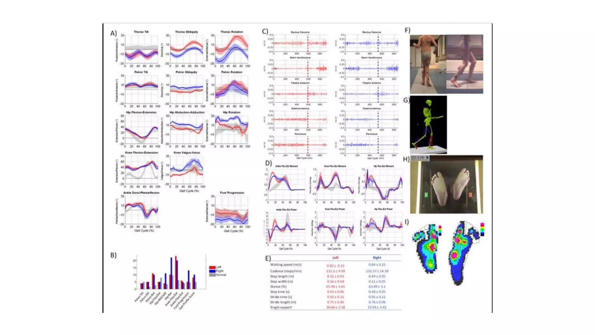 GAIT ASSESSMENT.pptx