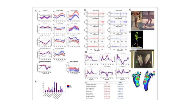 GAIT ASSESSMENT.pptx | Physical Therapy | Wellness