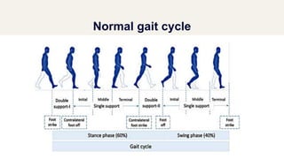 gait assessment.pptx