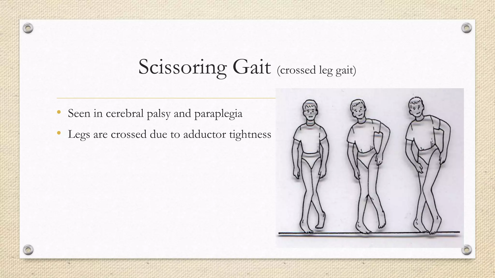 Abnormal Gait | PPTX