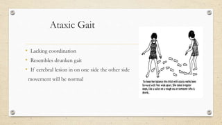 Abnormal Gait | PPTX