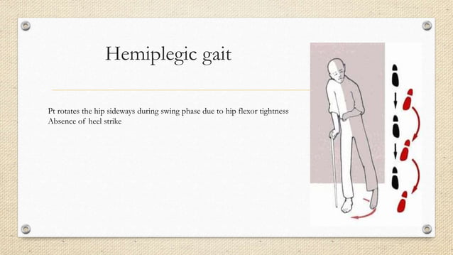 Abnormal Gait