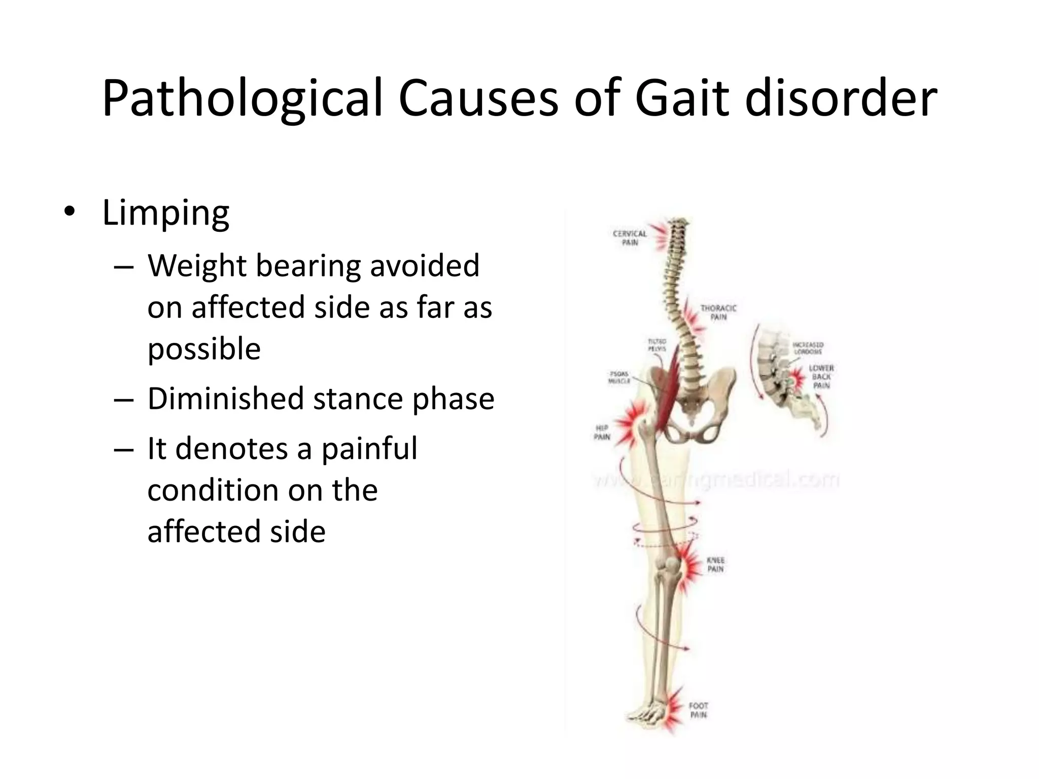 GAIT and it abnormality by Dr Umar Mohammed NOHIL | PPTX