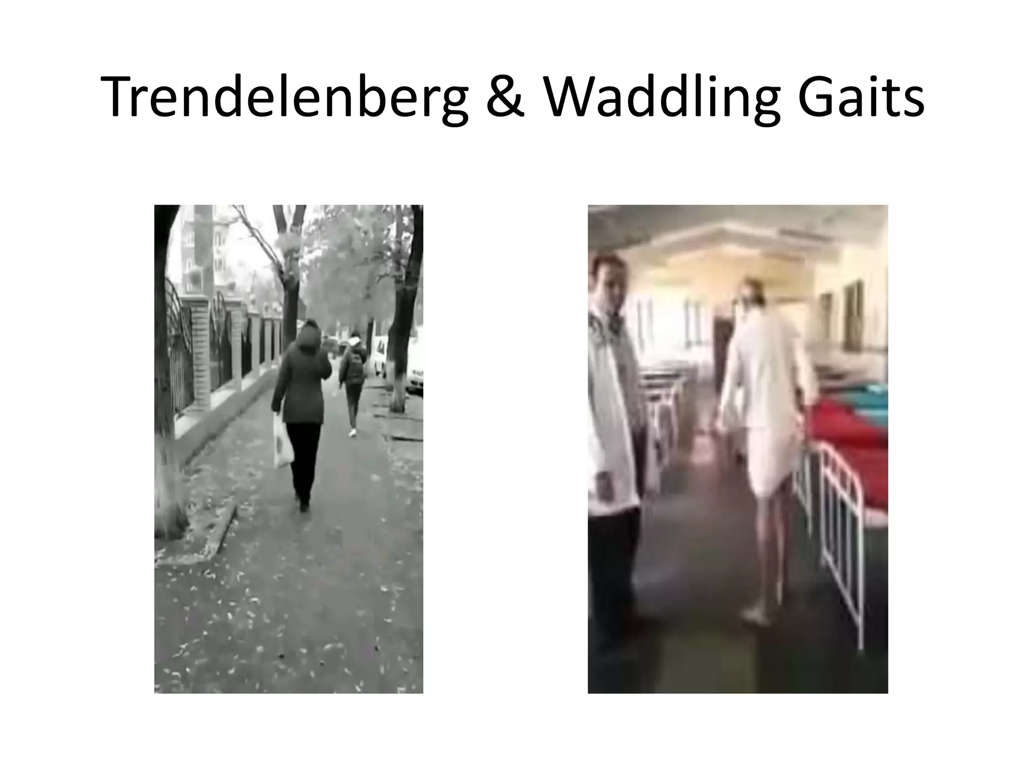 GAIT and it abnormality by Dr Umar Mohammed NOHIL | PPTX