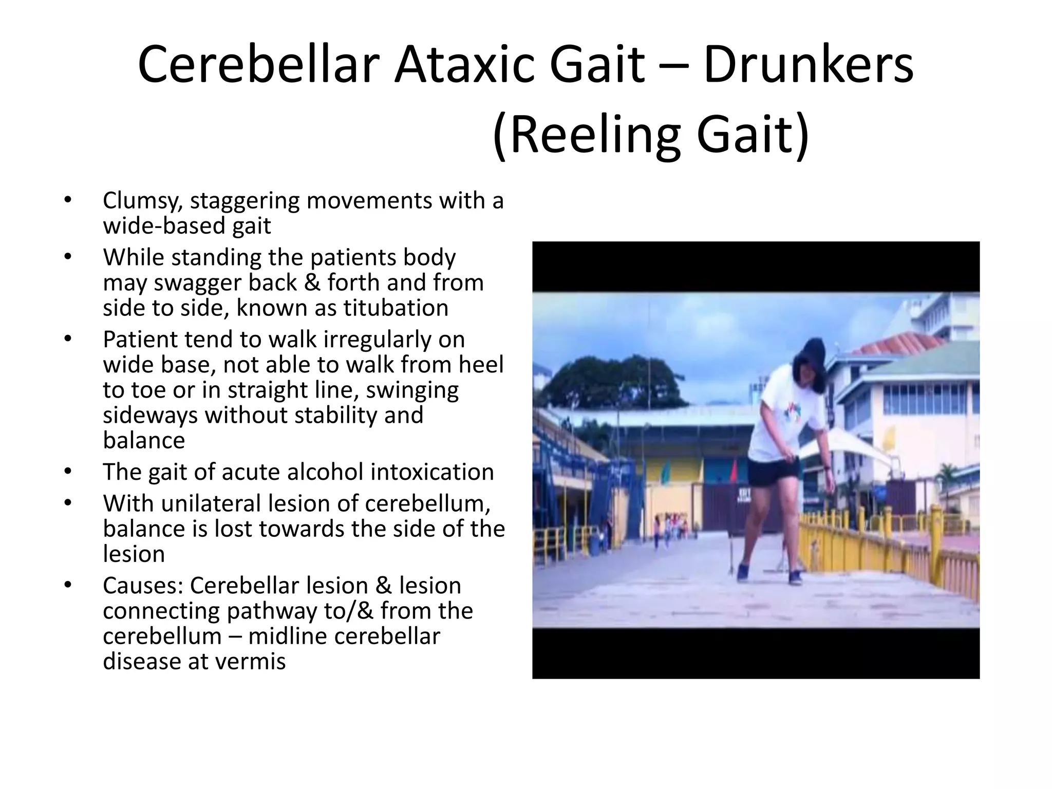 GAIT and it abnormality by Dr Umar Mohammed NOHIL | PPTX