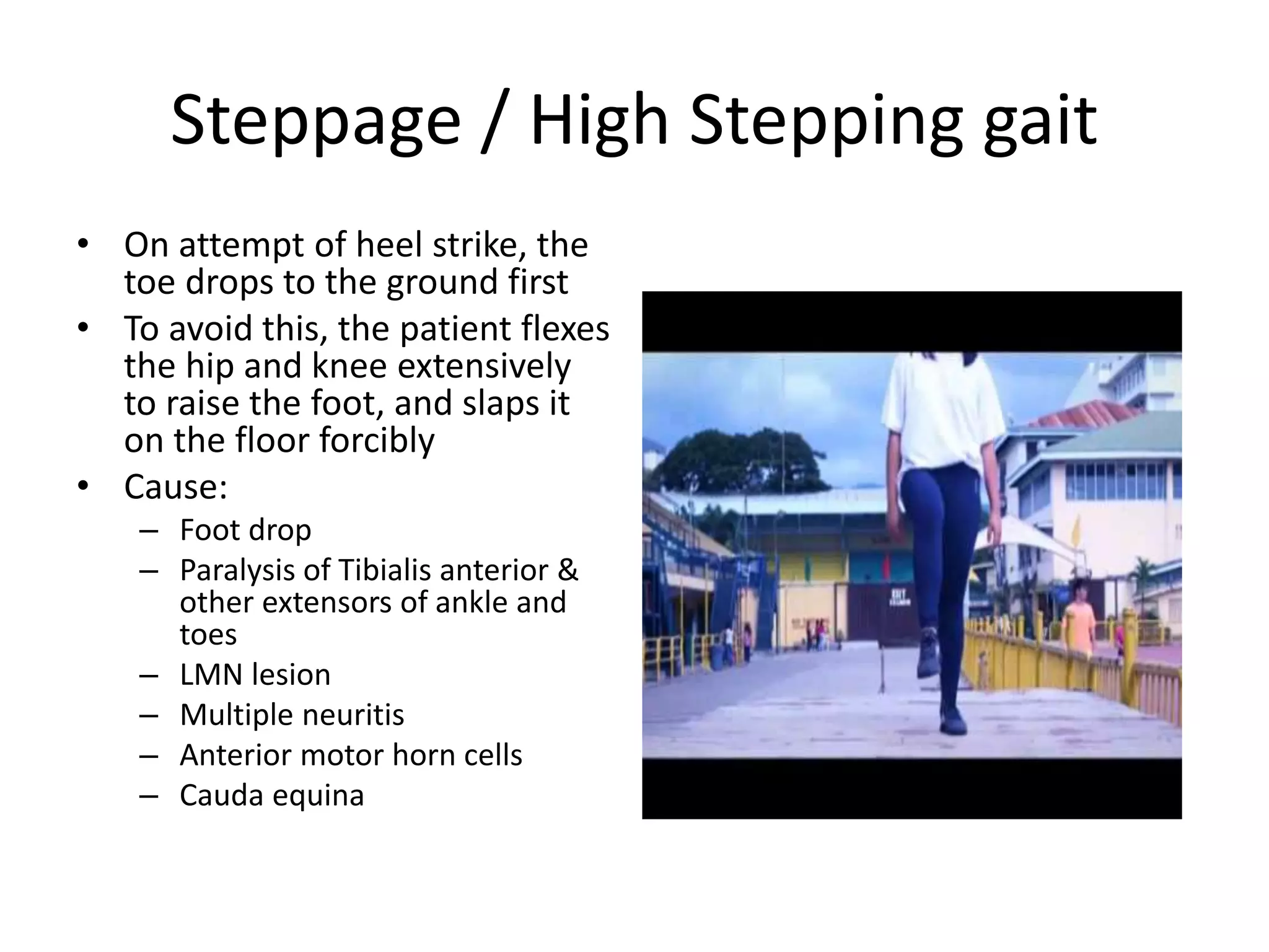 GAIT and it abnormality by Dr Umar Mohammed NOHIL | PPTX