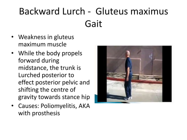 GAIT and it abnormality by Dr Umar Mohammed NOHIL | PPT
