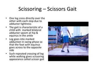 GAIT and it abnormality by Dr Umar Mohammed NOHIL | PPTX