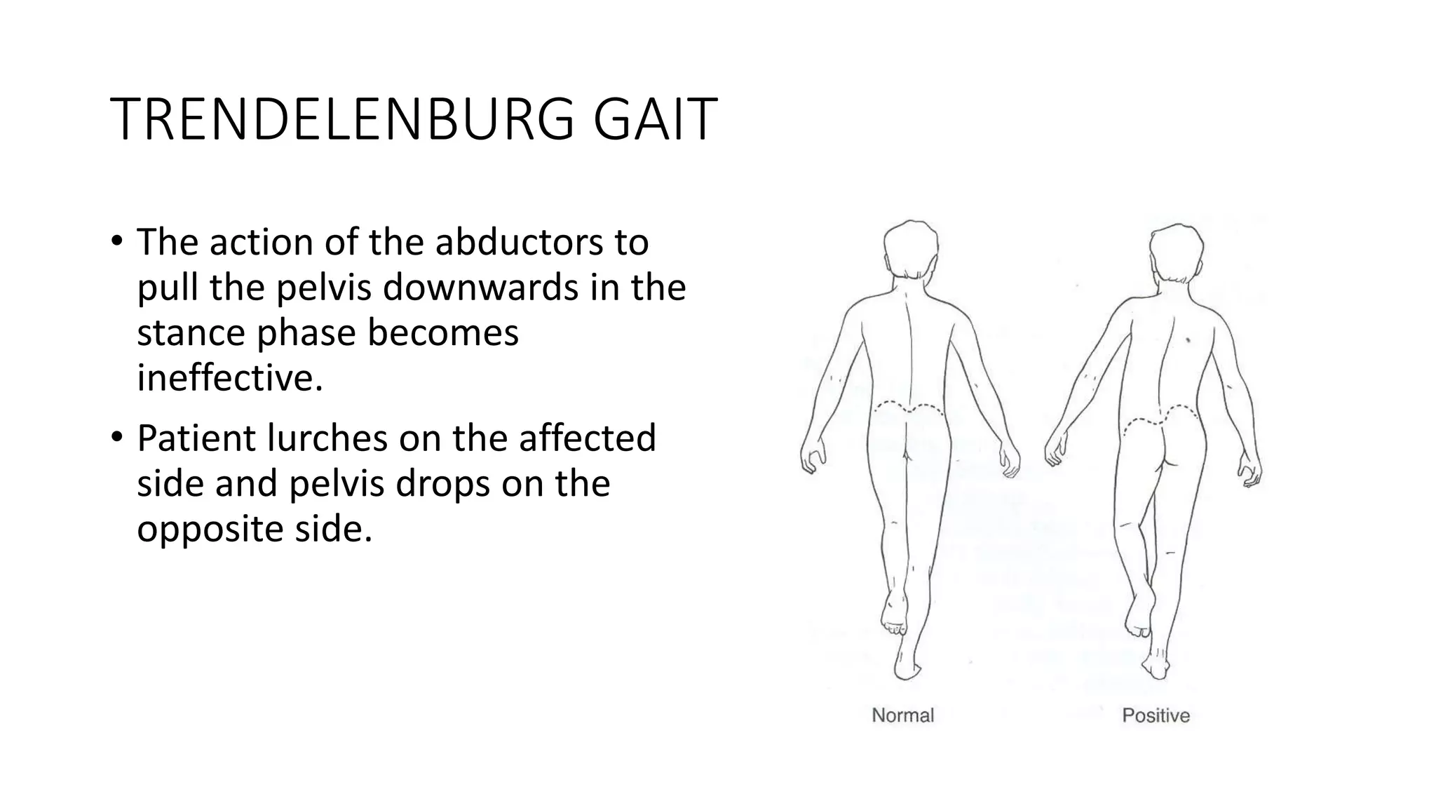 Gait cycle | PPTX
