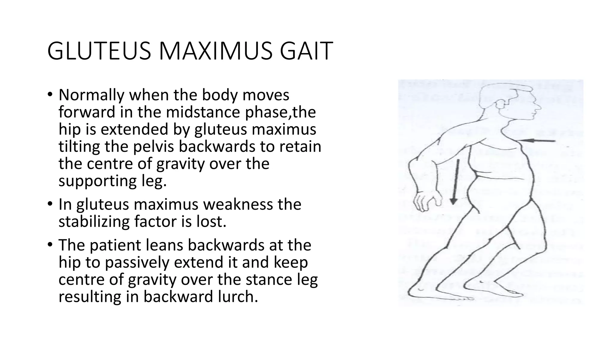 Gait cycle | PPTX