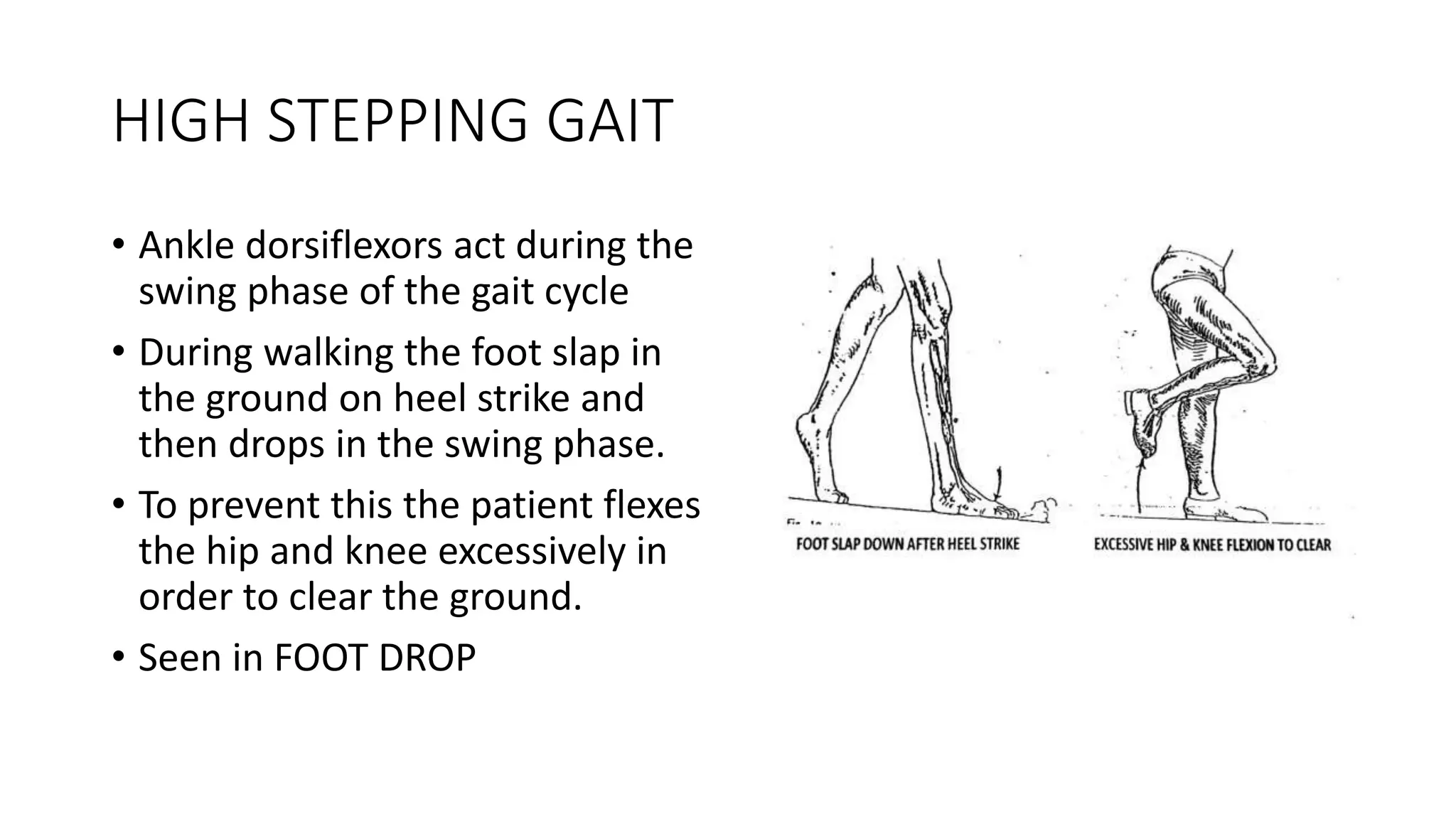 Gait cycle | PPTX