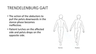 Gait cycle | PPTX