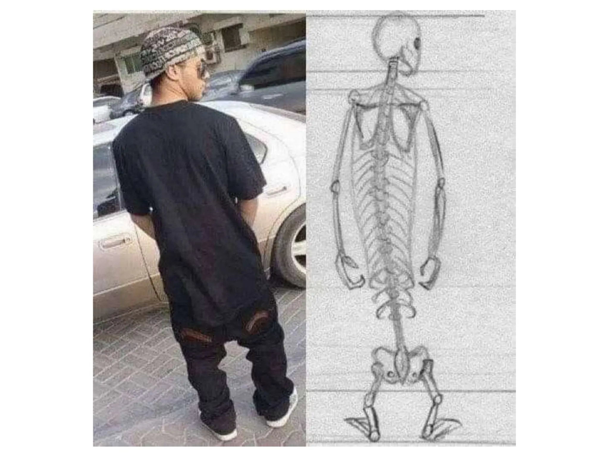 Gait Cycle- Gait pattern and some postural dysfunctions.pptx