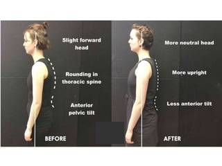 Gait Cycle- Gait pattern and some postural dysfunctions.pptx