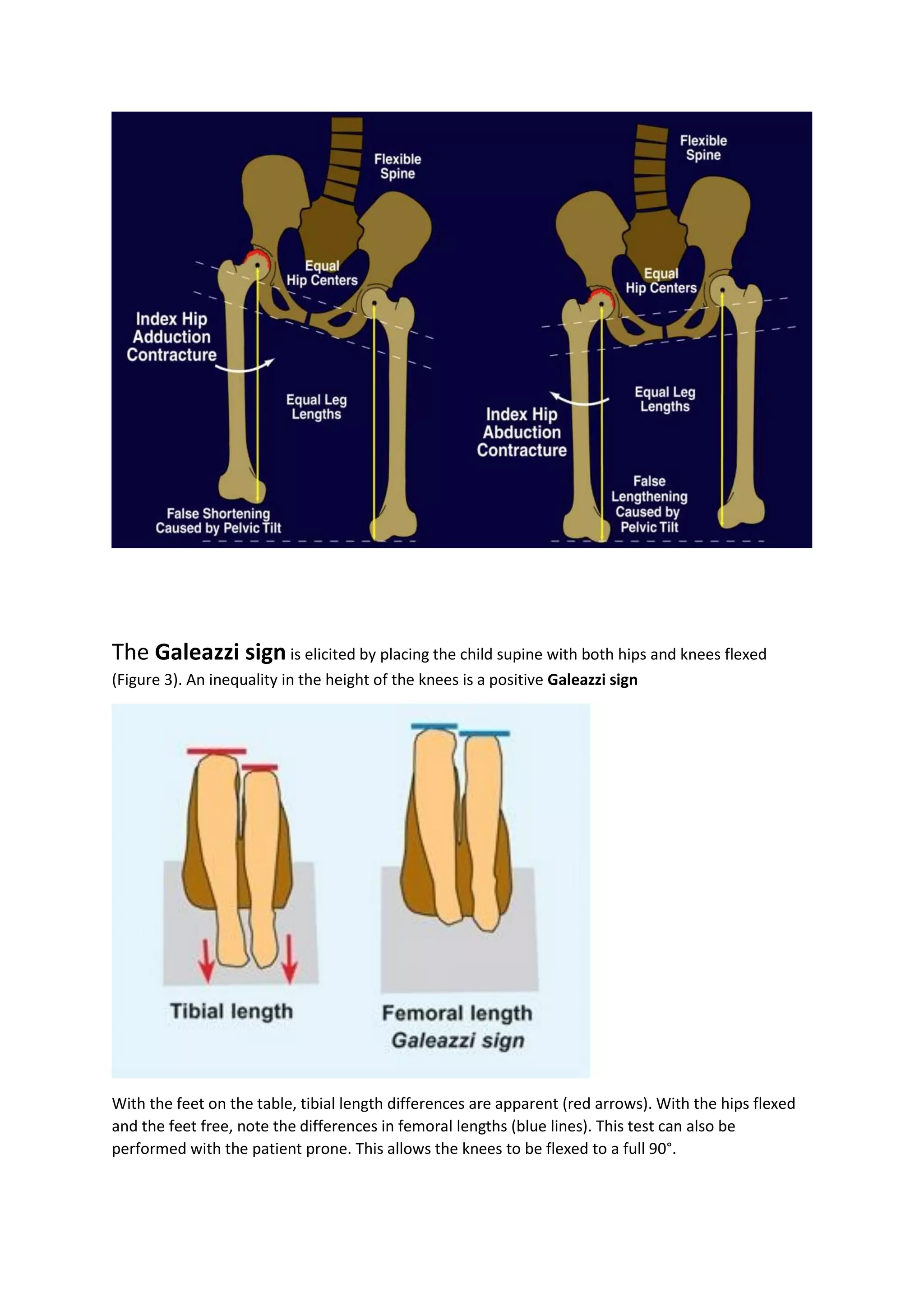 Gait cycle hip | PDF