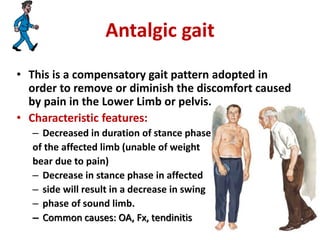 Antalgic Gait