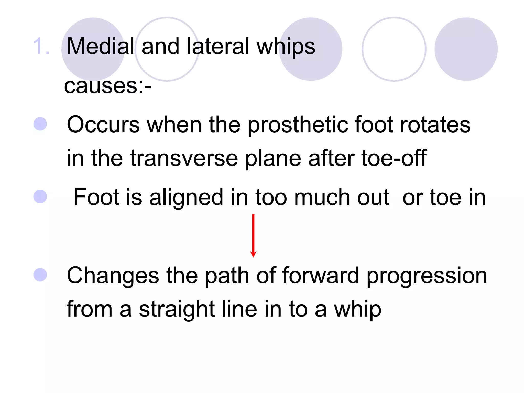 Gait deviation in prosthesis.ppt