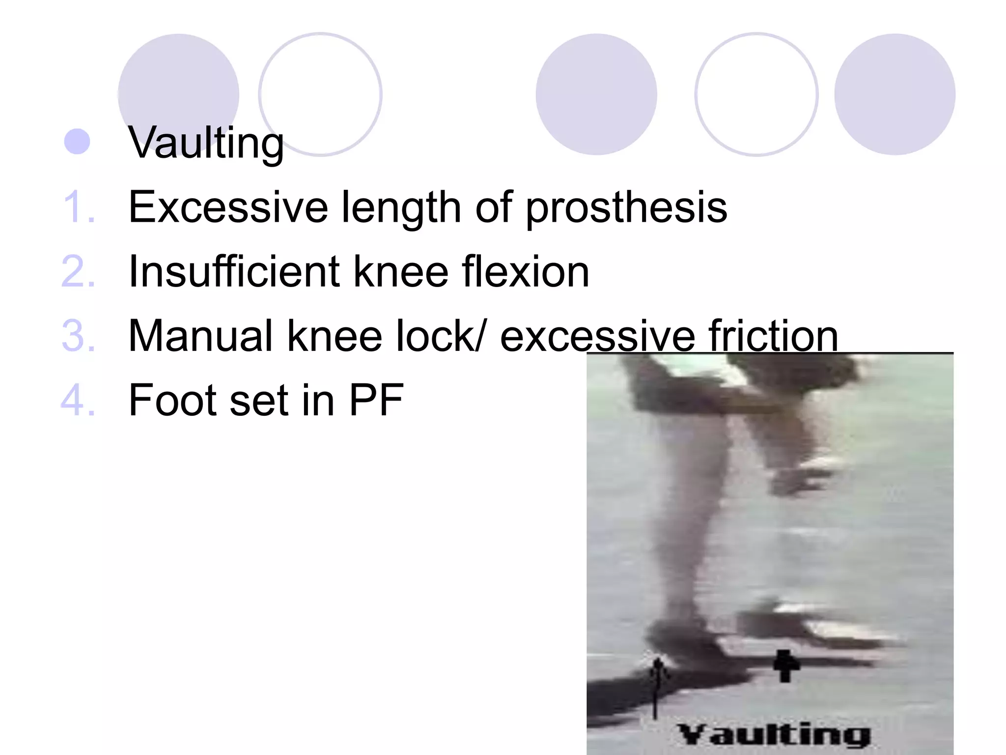 Gait deviation in prosthesis.ppt