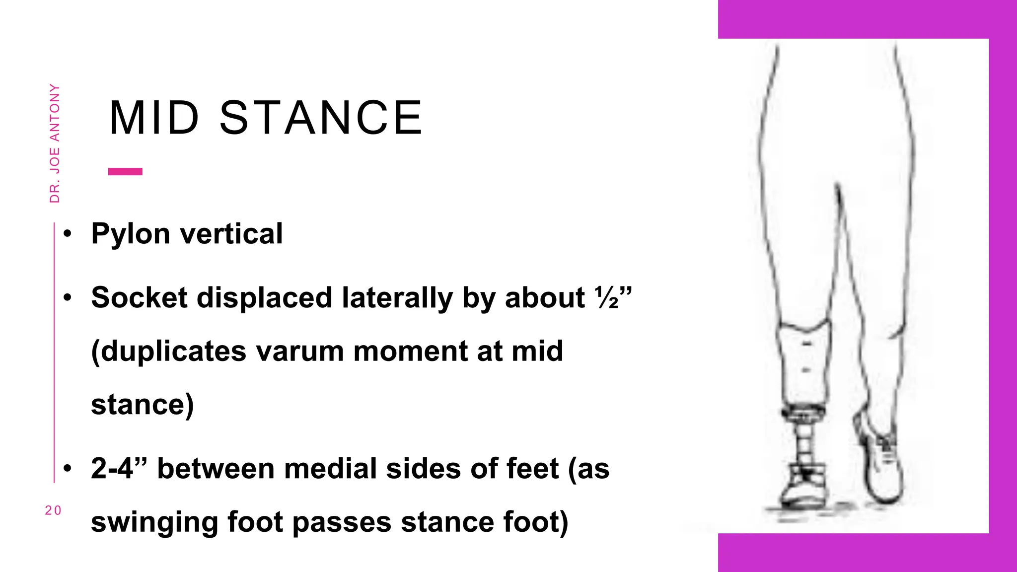 Gait deviations in Transtibial prosthesis users | PPTX