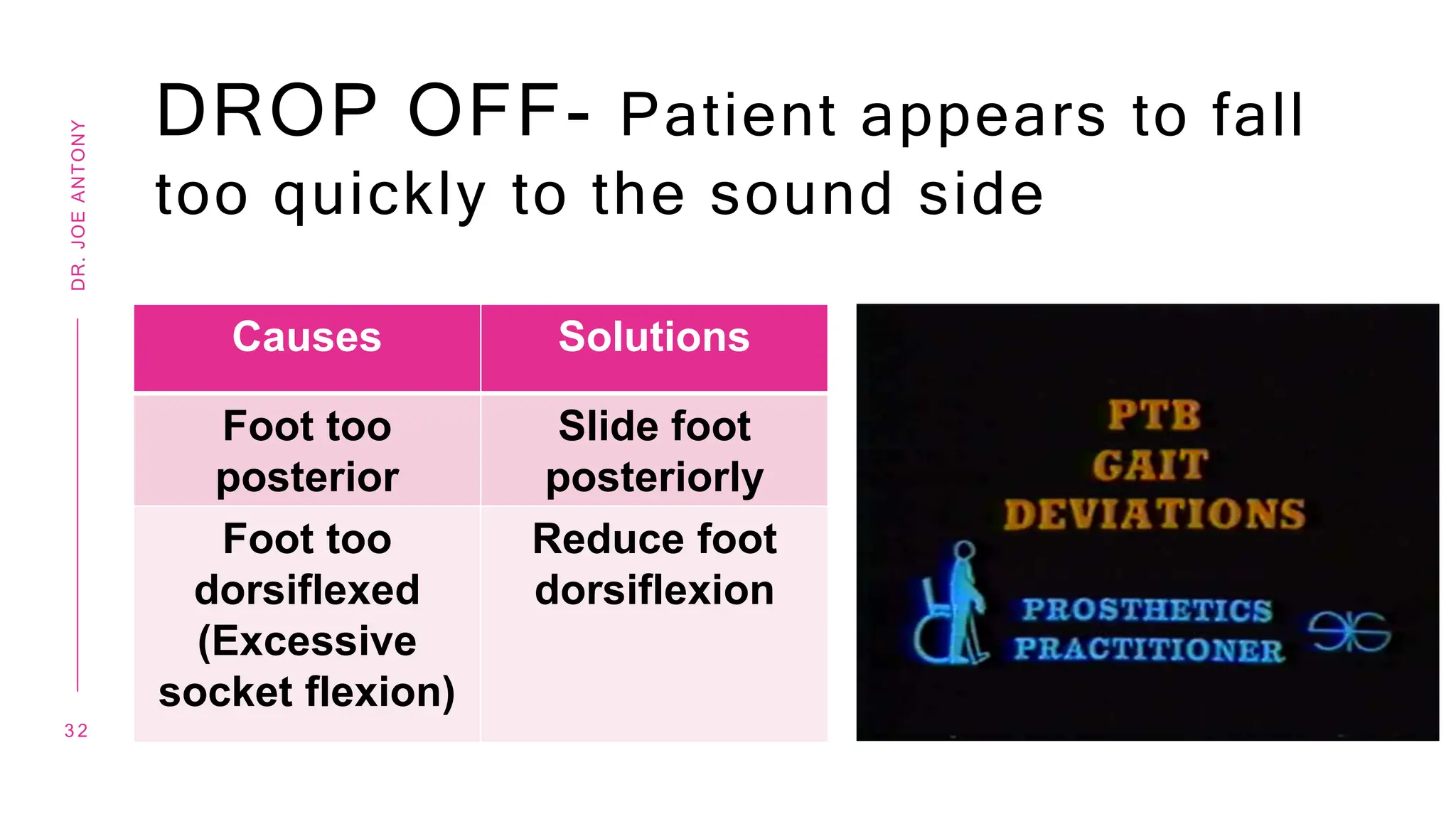 Gait deviations in Transtibial prosthesis users | PPTX