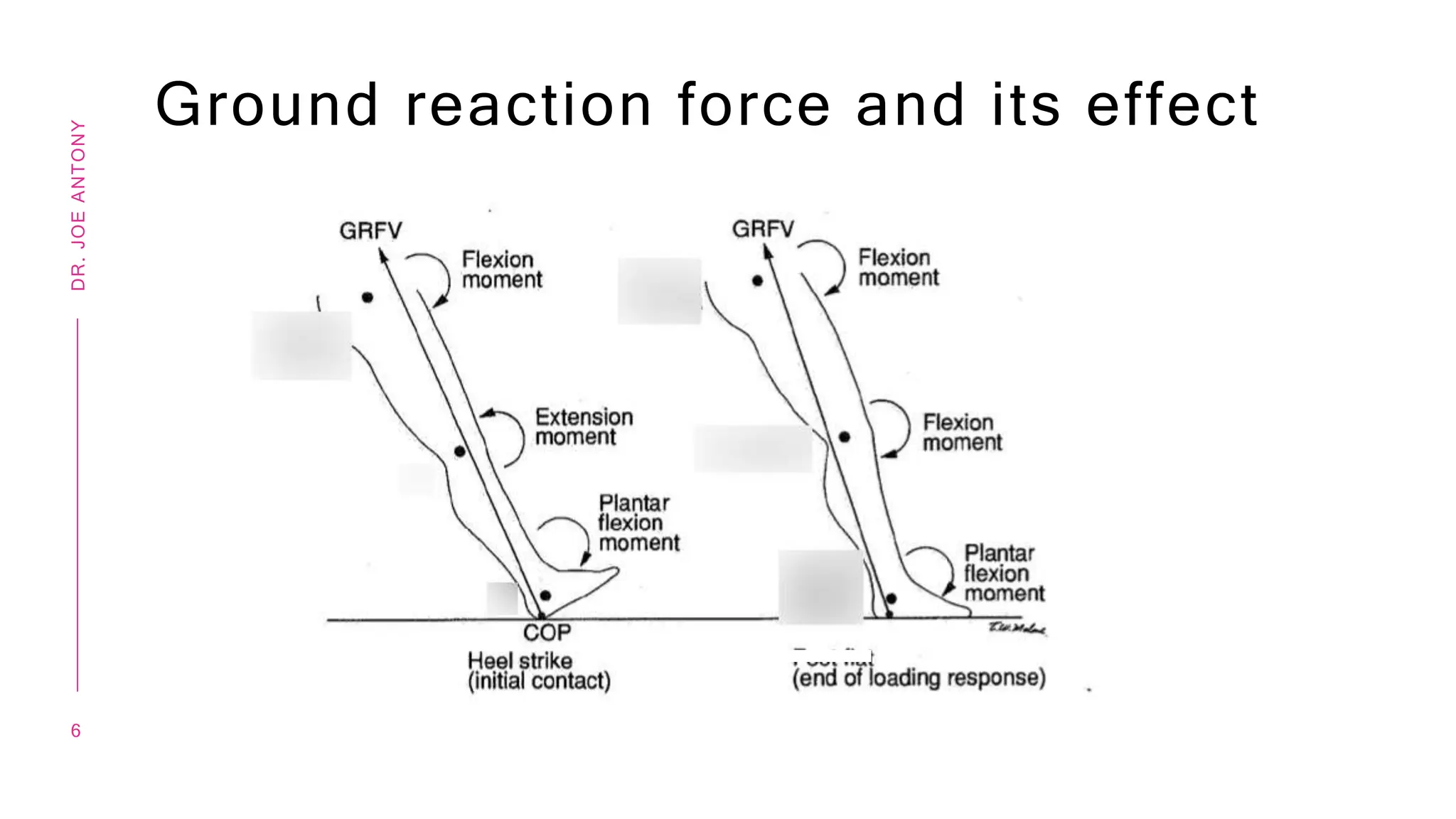 Gait deviations in Transtibial prosthesis users | PPTX