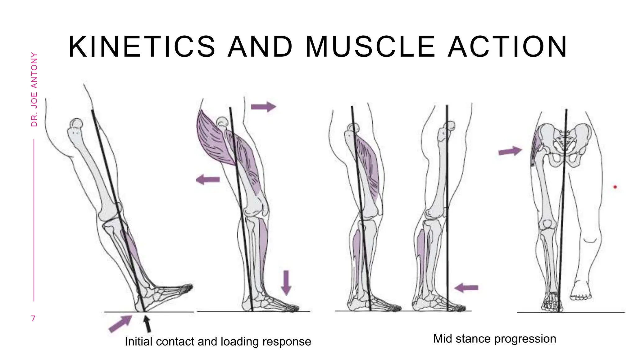Gait deviations in Transtibial prosthesis users | PPTX