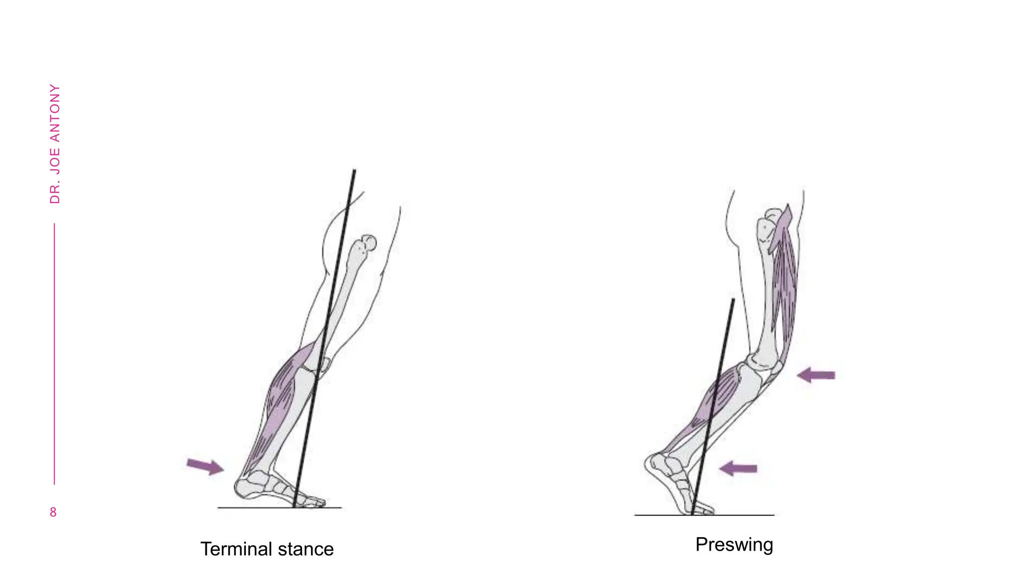 Gait deviations in Transtibial prosthesis users | PPTX