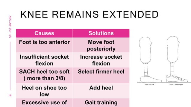 Gait deviations in Transtibial prosthesis users | PPTX