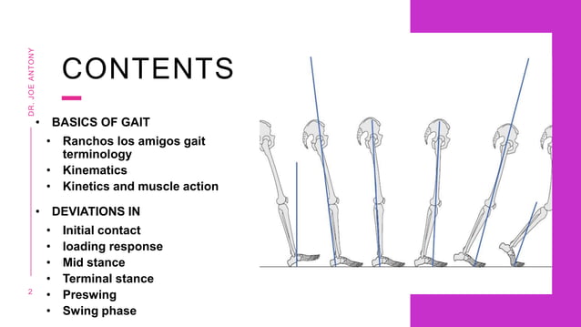 Gait deviations in Transtibial prosthesis users | PPTX