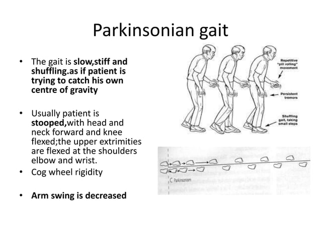 Gait disorders | PPTX