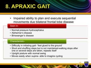 Apraxic Gait